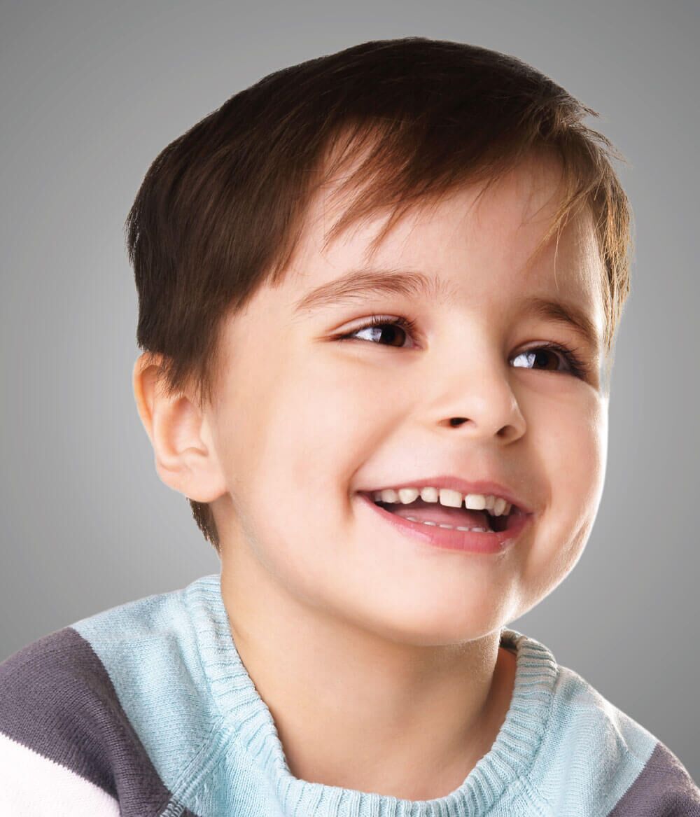 Space Maintainers for Kids in Dubai - Dr. Michael's
